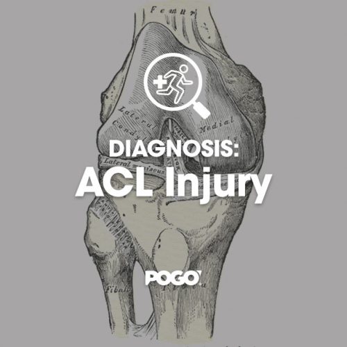 Diagnosis: ACL Injury | POGO Physio Gold Coast