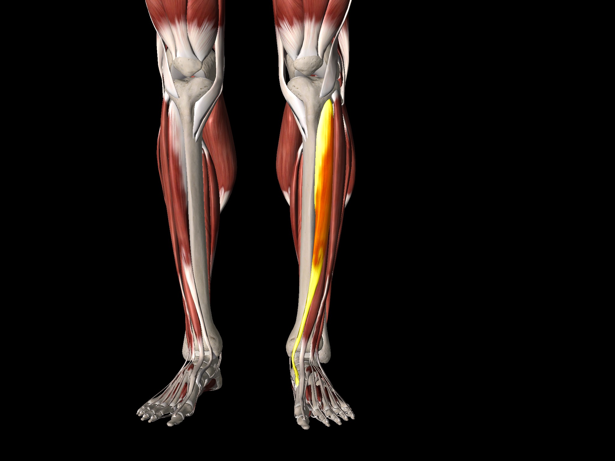 So you have ‘Shin Splints’? What to do next | POGO Physio Gold Coast