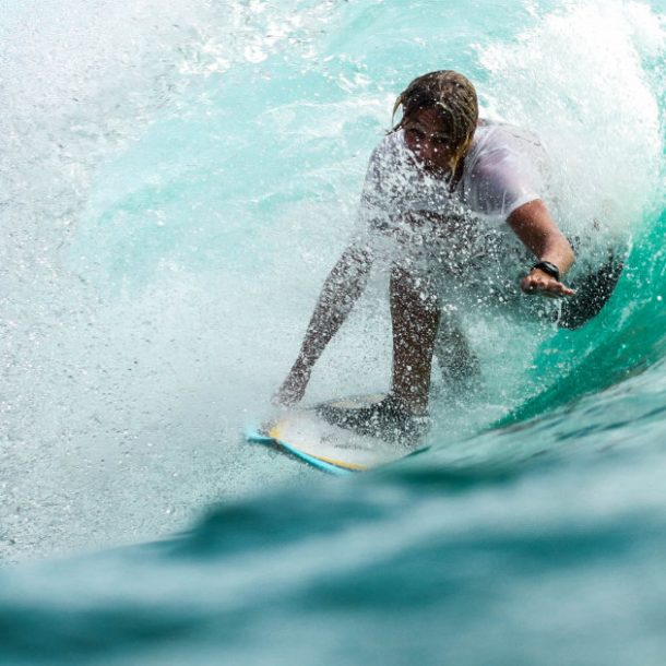 ACL Surgery: Cyclops Lesions | POGO Physio Gold Coast