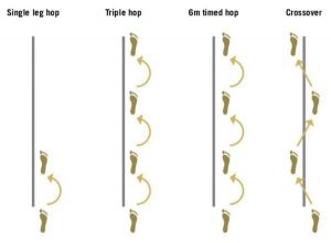 ACL Surgery: Return to Sport Testing | POGO Physio Gold Coast