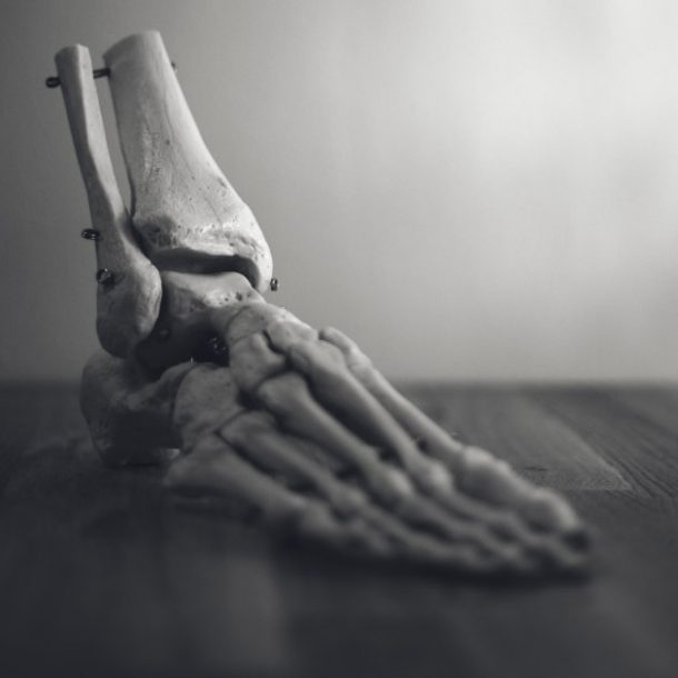 Different Types of Ankle Sprains and Implications for Recovery | POGO ...