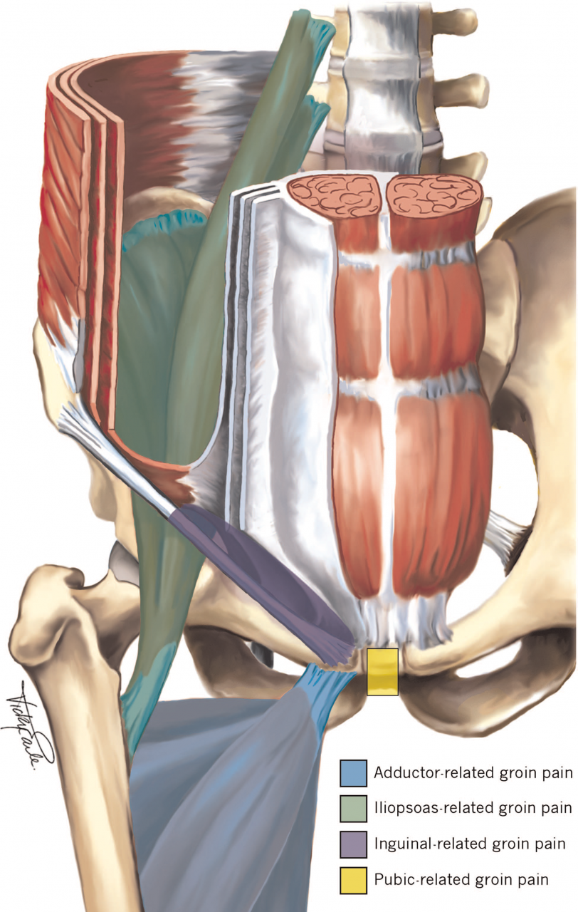 Hip and Groin Symposium 2017: Part 1 Diagnosis of Hip and Groin Pain ...