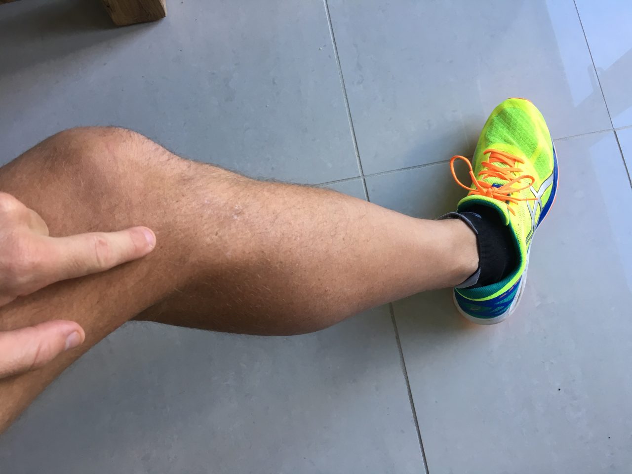 Part 1-Why ITB ‘Friction’ Syndrome is not due to ‘friction’ | POGO ...