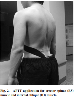 Taping for Low Back Pain | POGO Physio Gold Coast