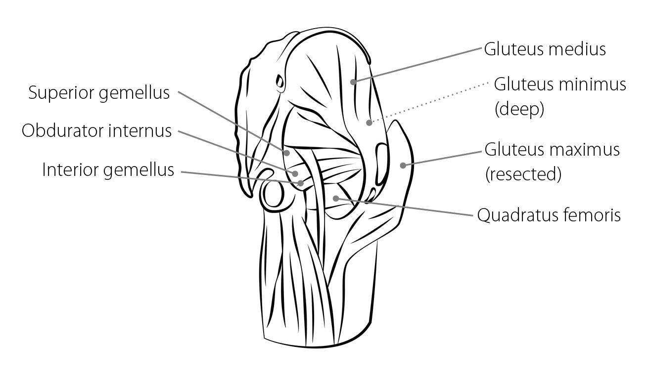 Glut Trigger Point Release Exercise-Pocket Physio | POGO Physio Gold Coast