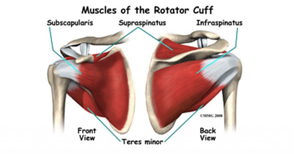 Rotator cuff tears: to operate or not? | POGO Physio Gold Coast