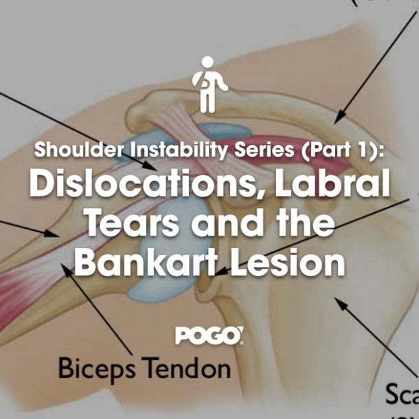 Shoulder Instability Series (Part 1): Dislocations, Labral Tears and ...